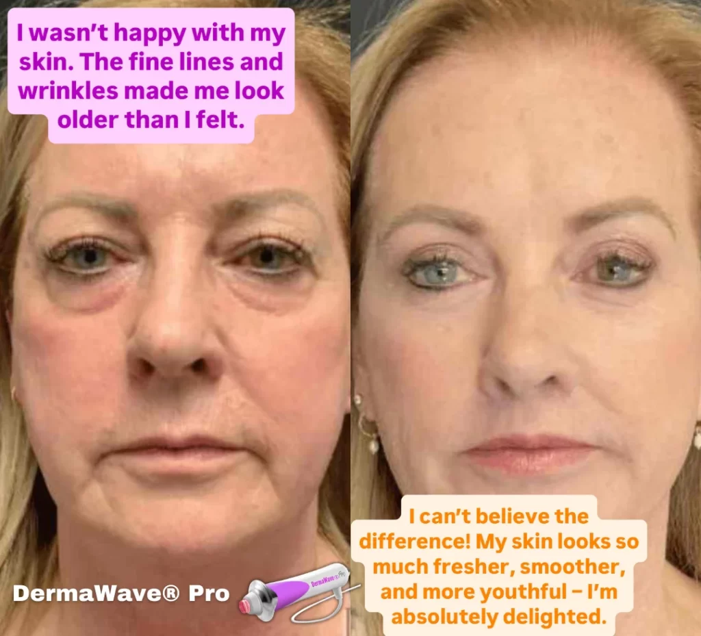 DermaWave Pro