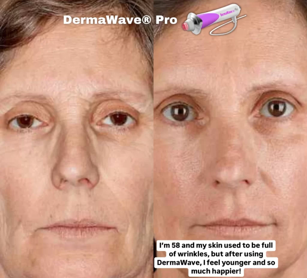 DermaWave Pro